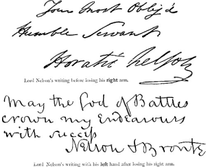 Nelson Loses An Arm – Nelson The Sailor
